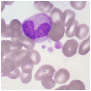 @Nãotemmaisfim@: Metamielócitos